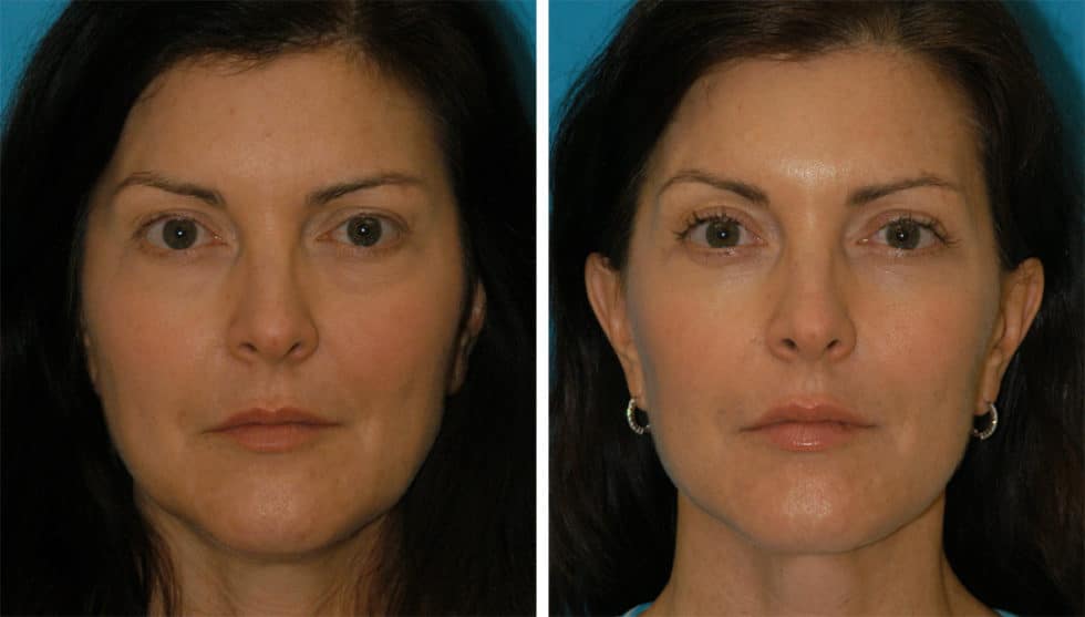 5 ways to make your face look more symmetrical