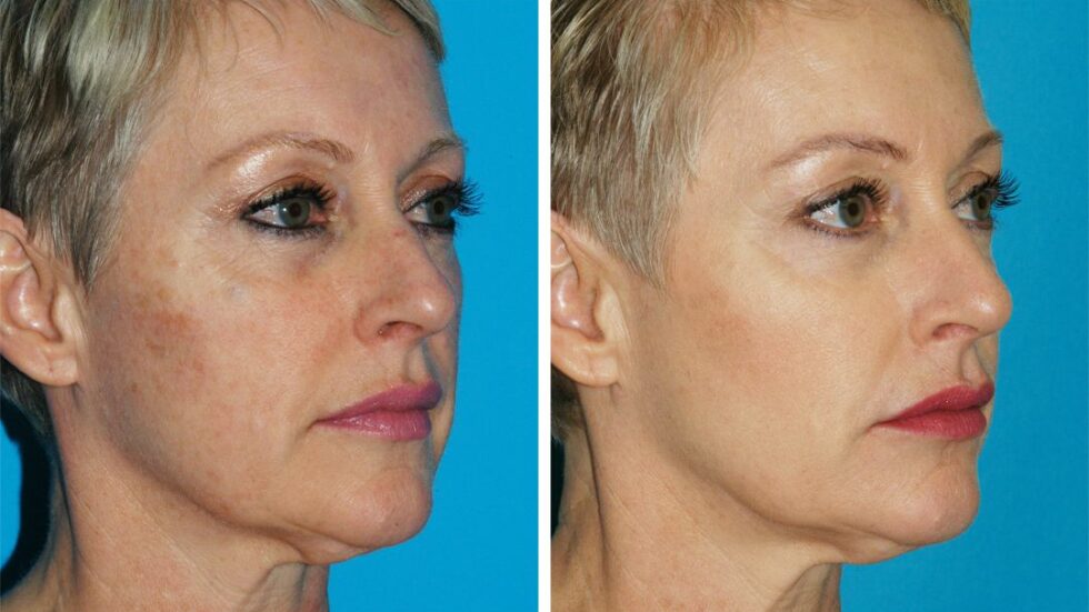 You Have Puffy Eyes and Dark Circles