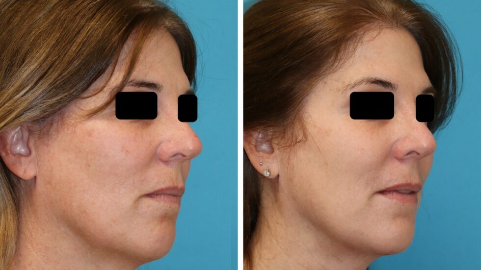 609.921.9497 Schedule Consultation Facebook instagram Request a ...