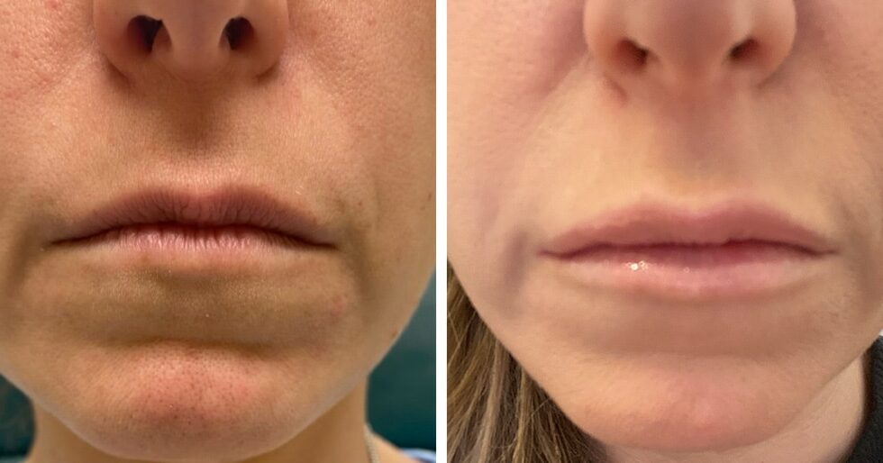 609.921.9497 Schedule Consultation Facebook instagram Request a ...