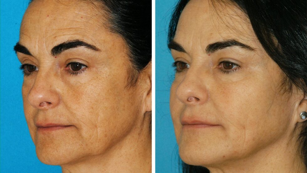 609.921.9497 Schedule Consultation Facebook instagram Request a ...