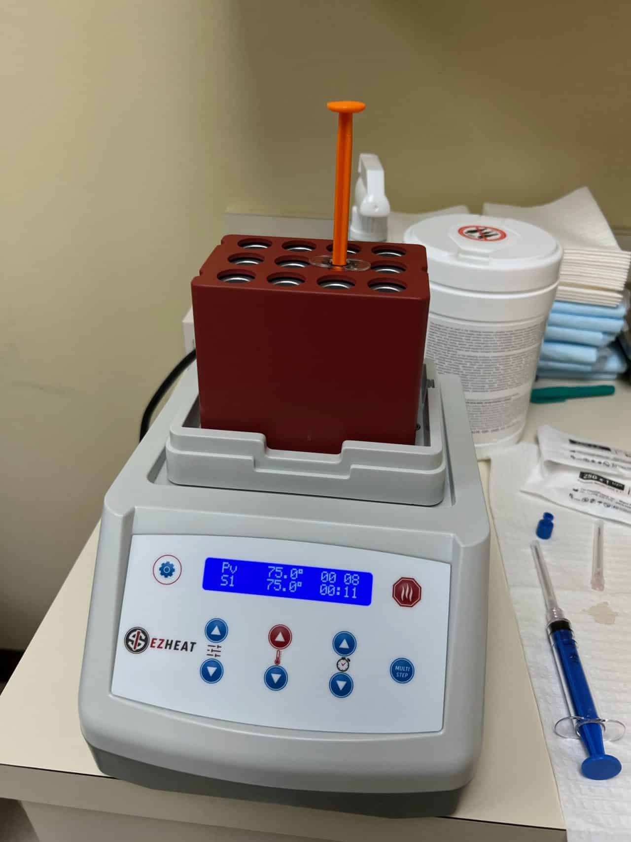 When Will I See Results After EZ PRF Injections?