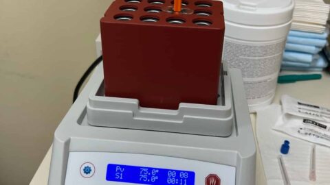 When Will I See Results After EZ PRF Injections?