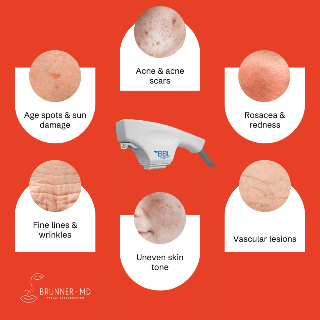 bbl-hero-brunner-princeton-nj1